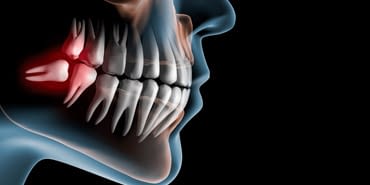 Maxillo Facial Surgery - Kamala Dental